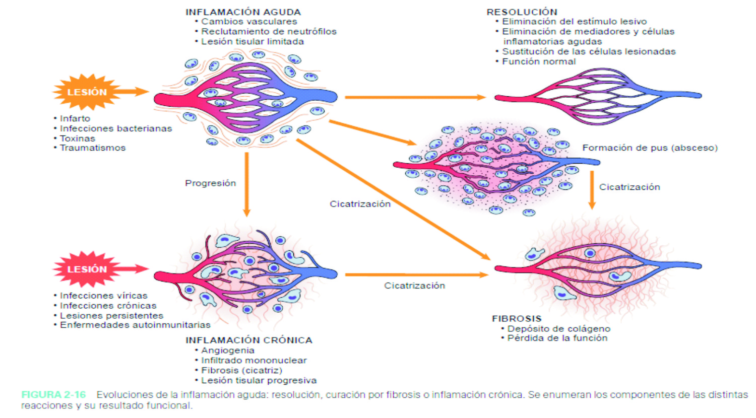 KINESIOLOGIA, EDUCACIÓN Y SALUD: RESOLUCIÓN RESPUESTA INFLAMATORIA