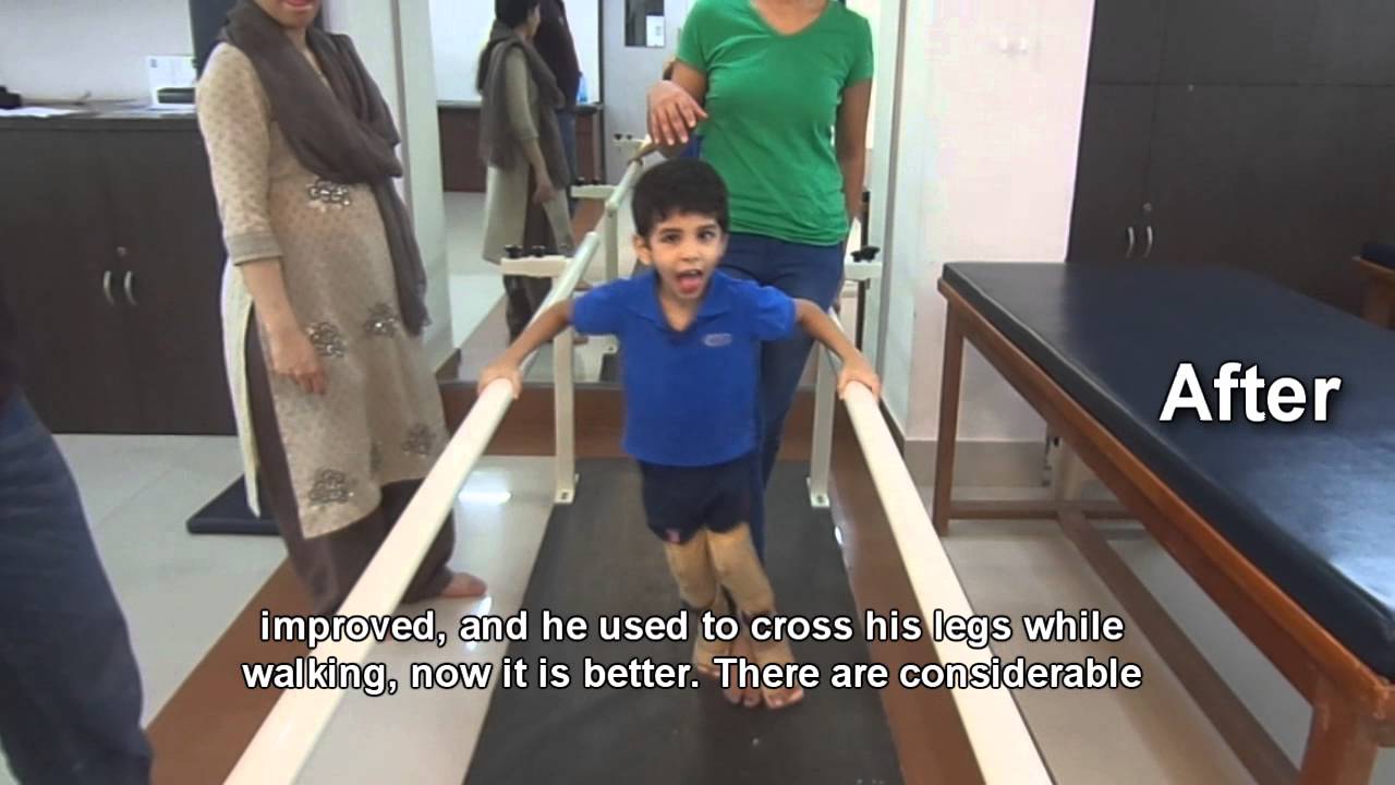 Cerebral Palsy Diagnosis Treatment Center: Quadriplegic spastic ...