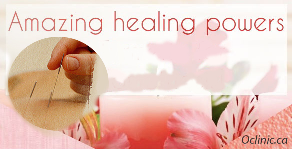 Acupuncture Massage Clinic Scarborough: Pursuing acupuncture treatment ...