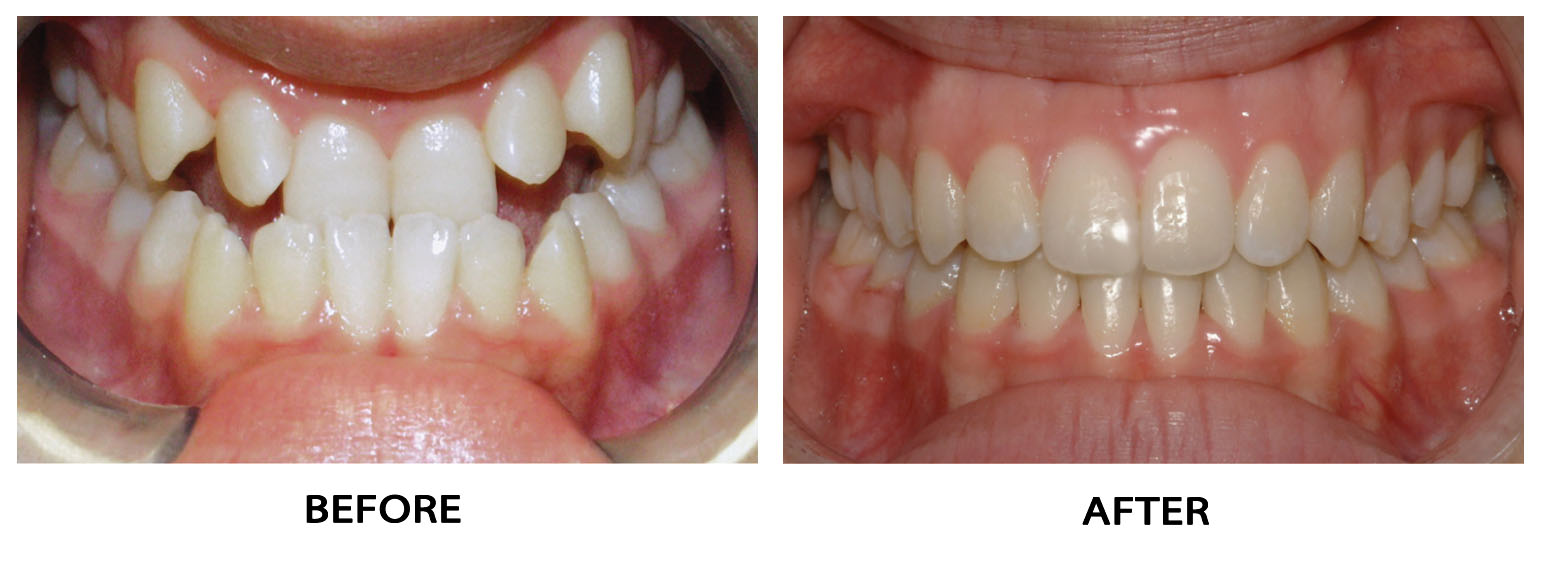 Al Fardan Orthodontics: COMMON PROBLEMS