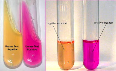 UREASE TEST - Microbiology Lab Notes