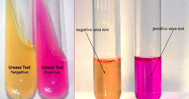 UREASE TEST - Microbiology Lab Notes