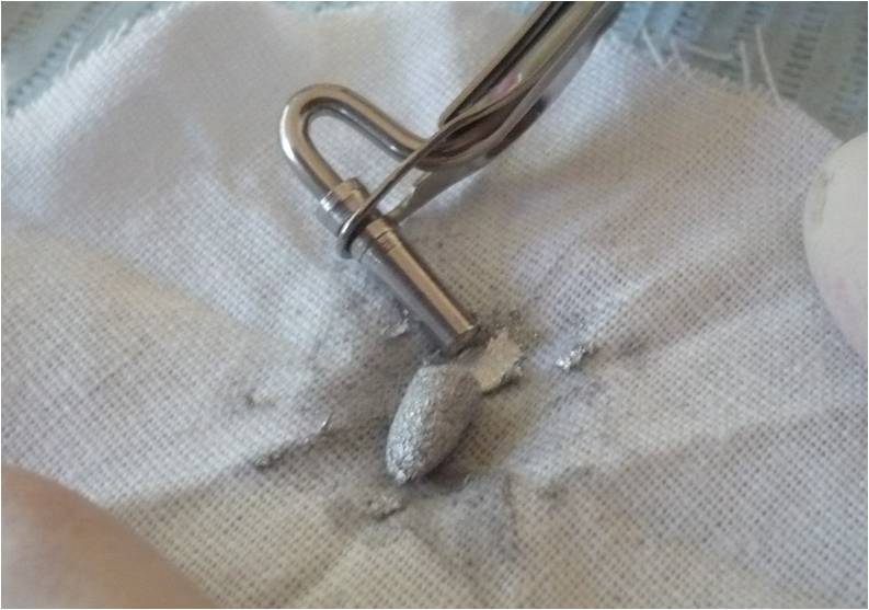 MATERIALES DENTALES FES: AMALGAMA DENTAL