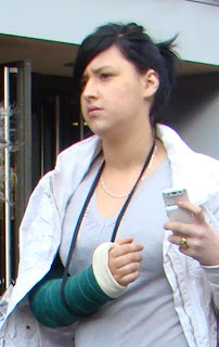 PTCaster: LAC (Long Arm Cast)