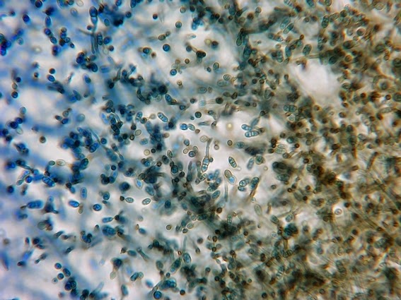 Fun With Microbiology (What's Buggin' You?): Ochroconis species