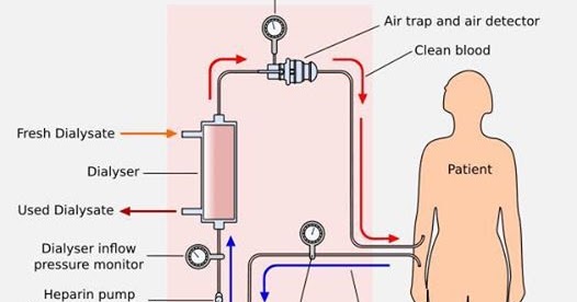 Best Kidney Disease Treatment Hospital : What Are The Side Effects of ...