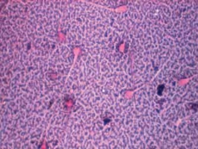 [Haematology] Atlas of Semen Analysis | Free Medical Atlas