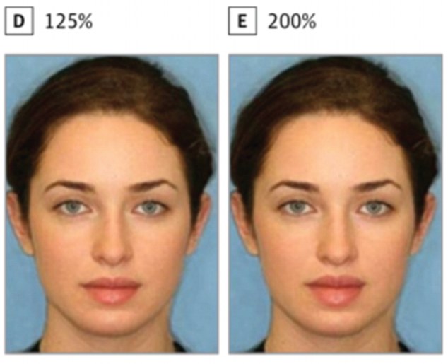 Plastic and Cosmetic Surgery: Science Identifies "Ideal" Female Lip Shape
