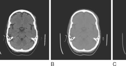 ER goldbook: Basic CT brain