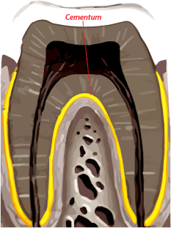 Cementum - facts you would need to know - Remedy Land