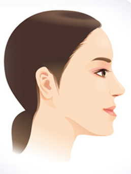 BK Plastic Surgery: [BK Plastic Surgery] Protruding Chin Correction