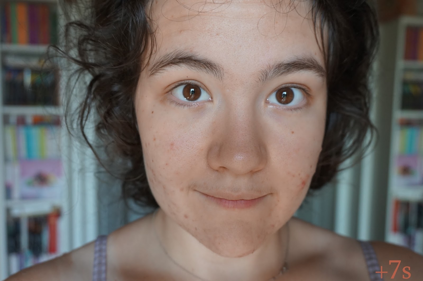 At War with Acne: Cicalfate & TriAcnéal Expert (Avène) won ! - Flavour ...