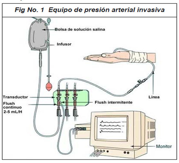 MONITORIZACIÓN HEMODINÁMICA INVASIVA.