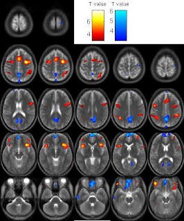 Head of Neuroscience: fMRI, the basics