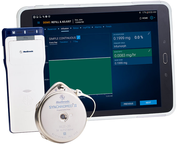 Medtronic’s Synchromed II Approved to Pump Remodulin Into Veins to ...