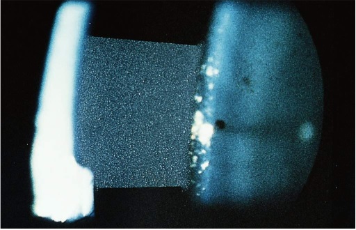 [Emergency] ATLAS OF ANTERIOR UVEITIS (IRITIS) | Free Medical Atlas