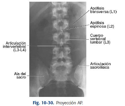 PRODUCCION Y TRATAMIENTO DE IMAGENES DIAGNOSTICAS: CAPITULO COLUMNA ...