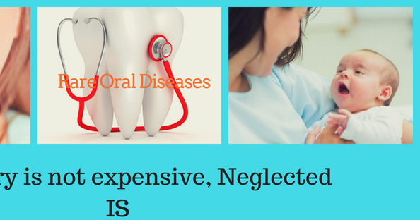 Rare Oral Diseases