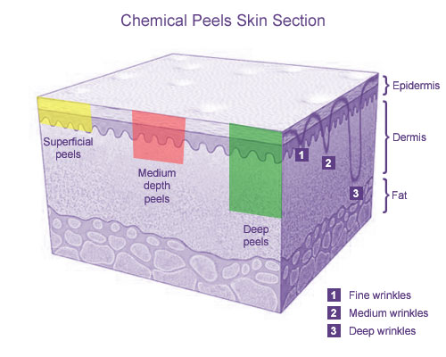 DIY Skin Care SEA Lab: Acids/ pH and pKa relationship