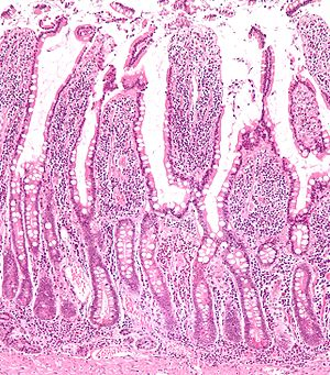 Structure of villi | MEDICAL TODAY