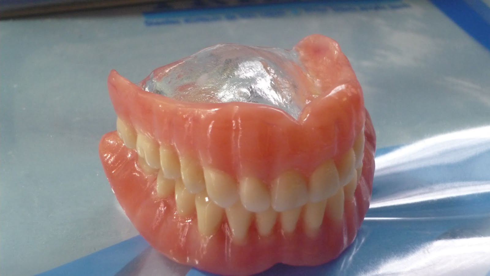 Odontologia com carinho: Próteses Removíveis