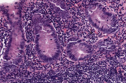 MoyinAdesanyaBiol 3500: The Human Appendix: My Favorite Organ: The ...