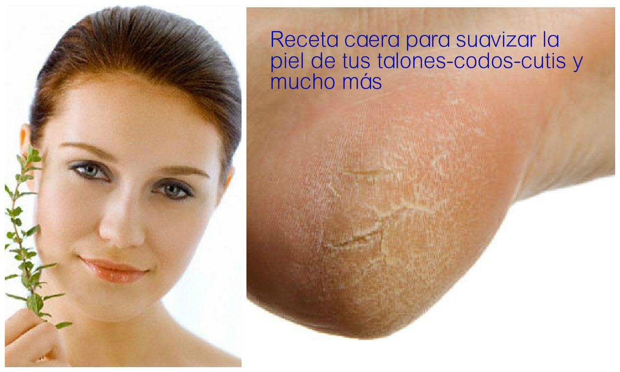Cómo suavizar la piel- brazos-cutis- talones y codos ~ cositasconmesh