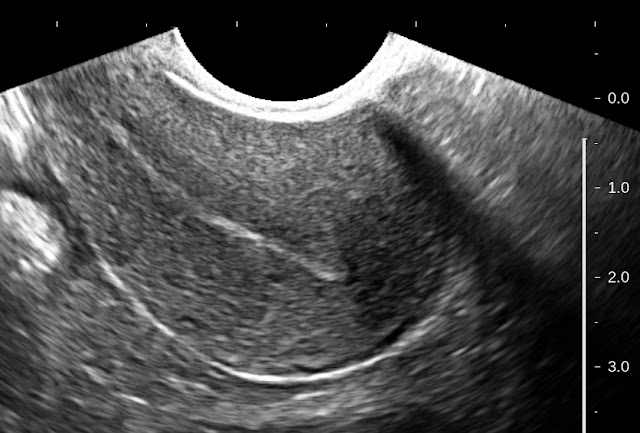 The Art of Ultrasound