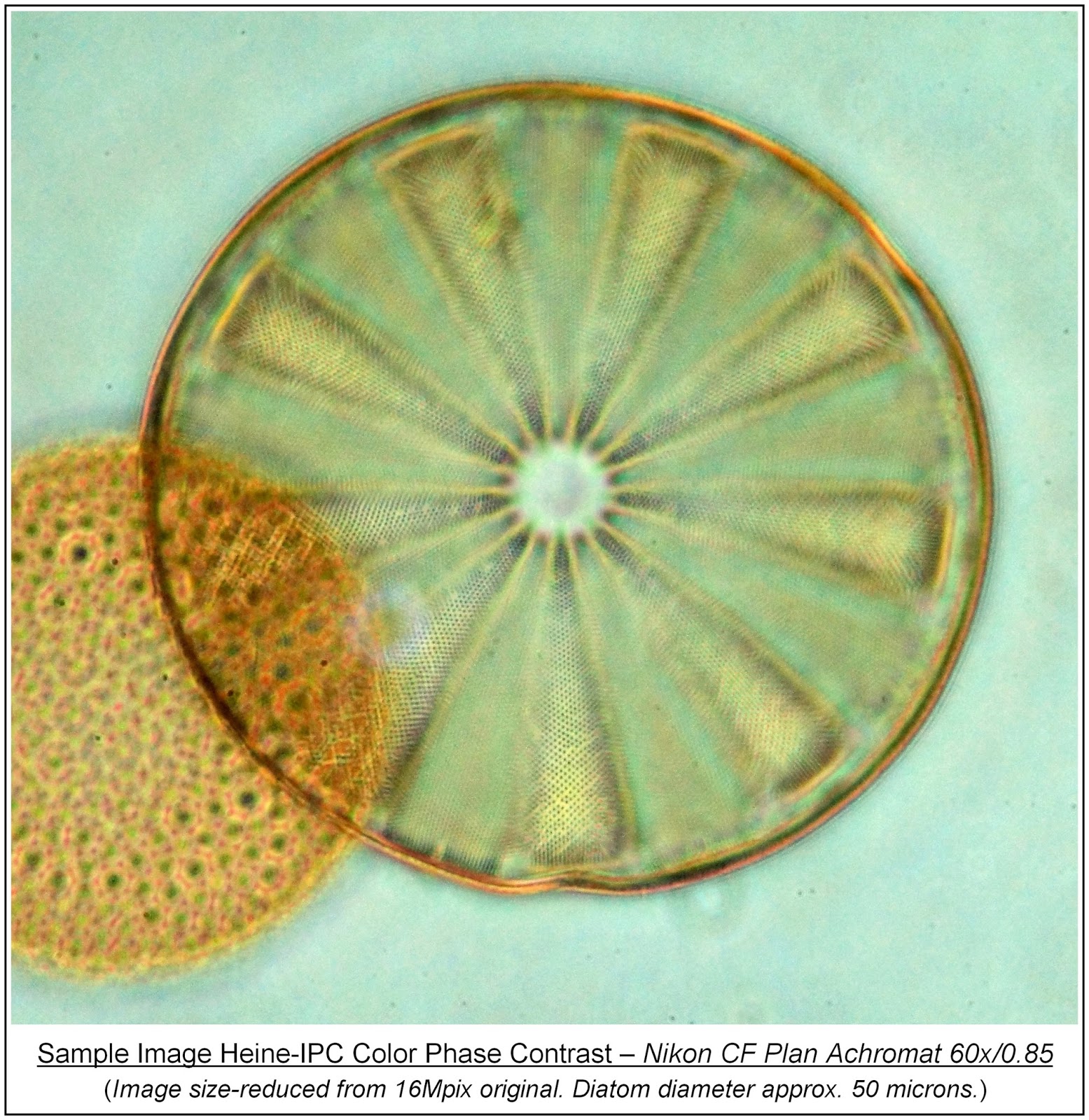 Better Microscopy -- the blog : 'Heine-IPC': COLOR Phase Contrast ...