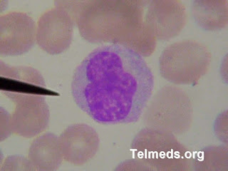 Atlas Hematològico: Secuencia de Maduración de Monocitos
