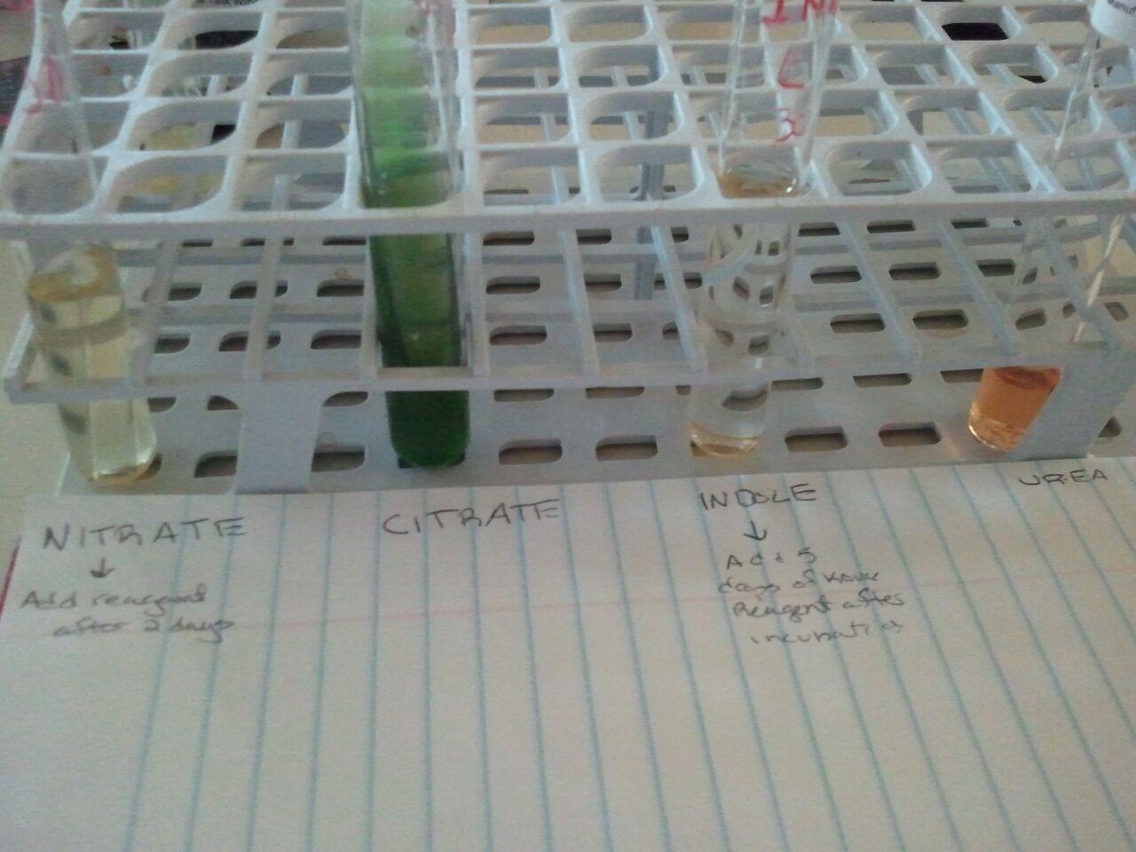 Microbiology Lab: Lab 11/8: Nitrate, Citrate, Urea, Indole