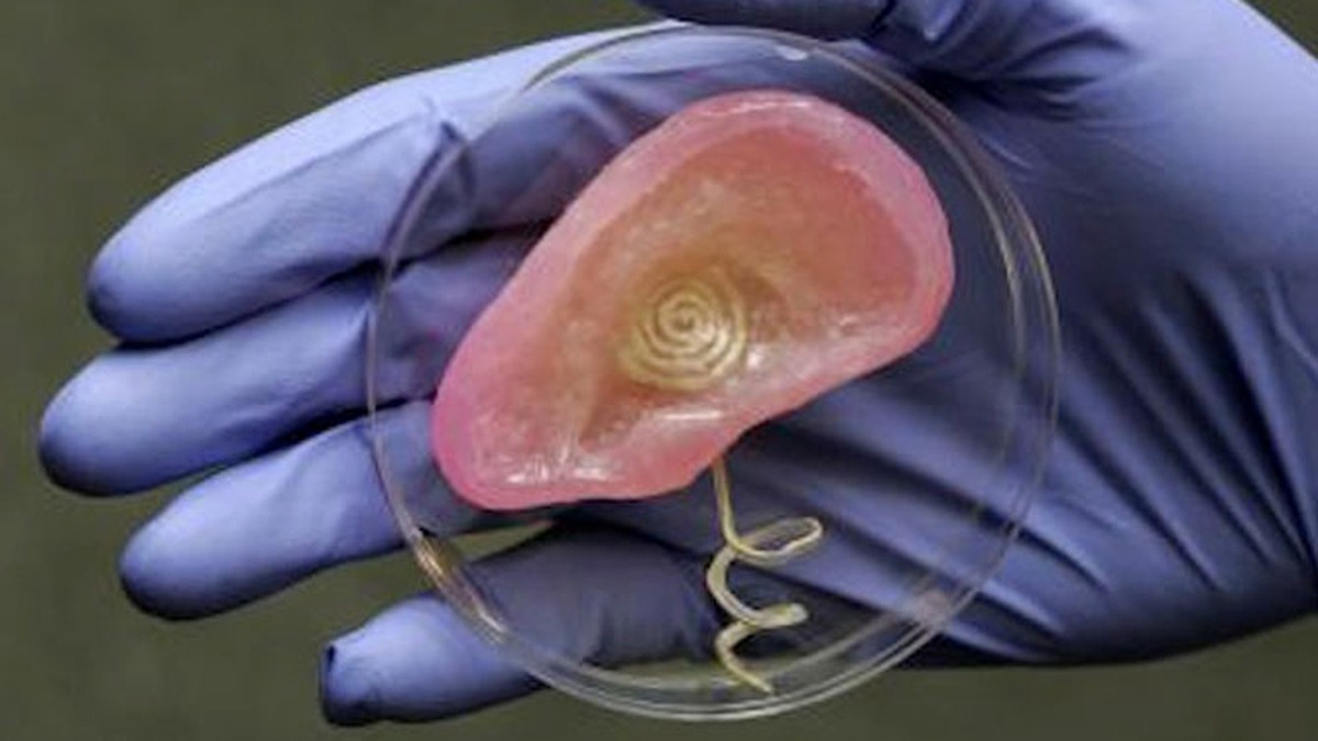 10 Bioengineered Body Parts That Could Change Medicine - health ...