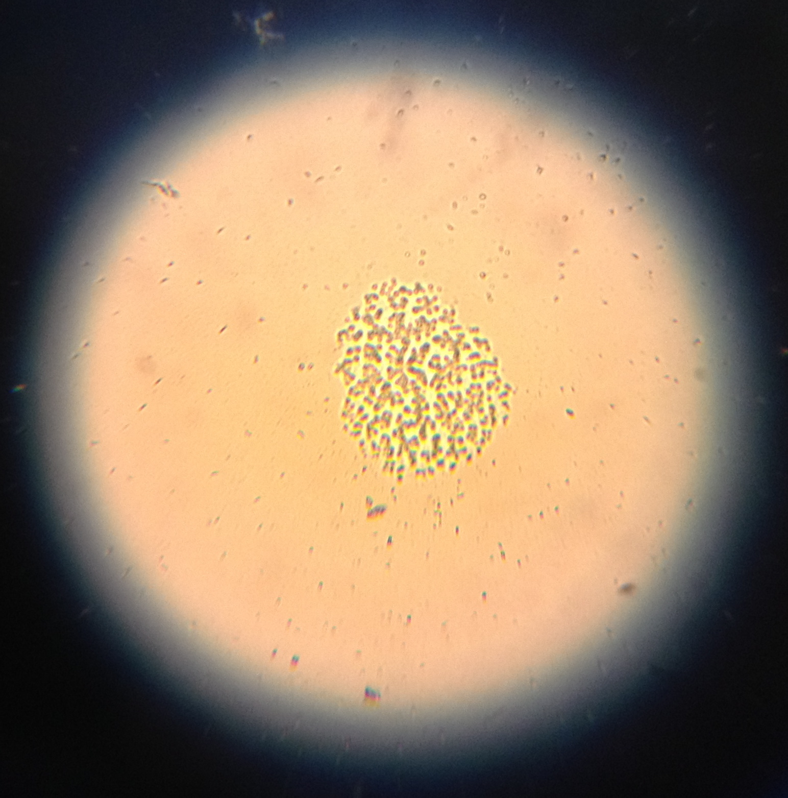 Hershie's Blog: Wart Virus (Under a Microscope)