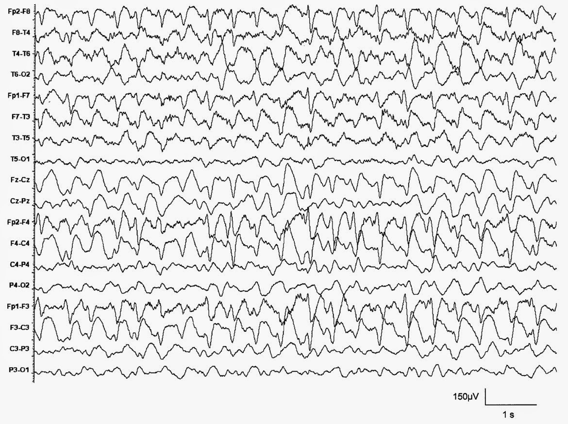 El rincón del programador: Tratamiento de señales EEG con OpenViBE