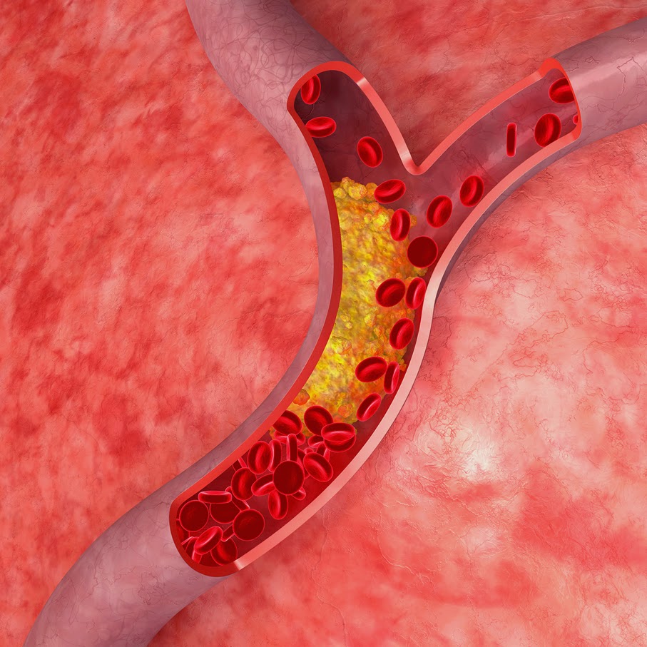 Tudo aquilo que devia saber sobre o colesterol - REVISTA REVIVER