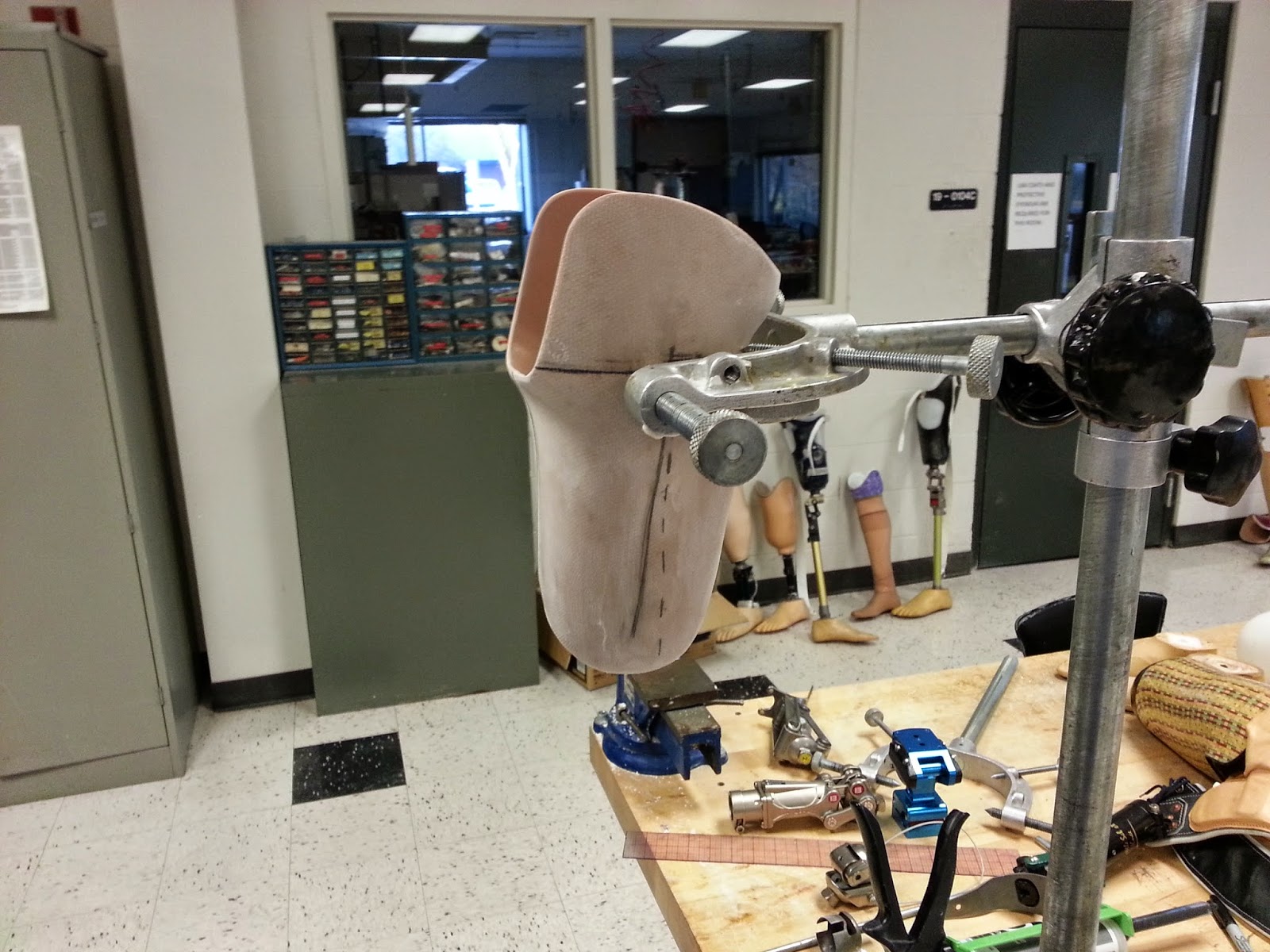 Prosthetic Projects: PTB Exoskeletal Prosthesis