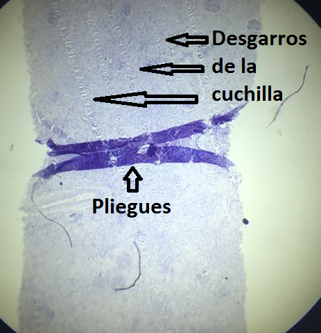 PROCESAMIENTO HISTOLÓGICO.: CORTES HISTOLÓGICOS CON ARTEFACTOS
