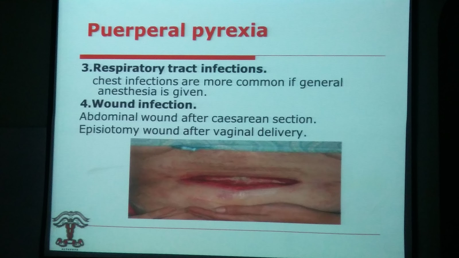 Lecture Slides : Gynecology; Puerperal pyrexia