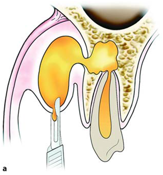 Dentistry and Medicine: Fundamental Principles of Treatment of ...