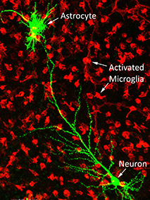 Le Cerveau de l'Enfant et de l'Adolescent: La Microglie