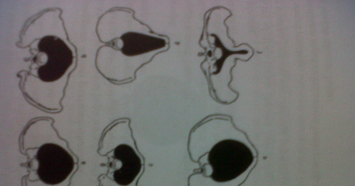 Ukuran Diameter Rahim Normal - Soalan as