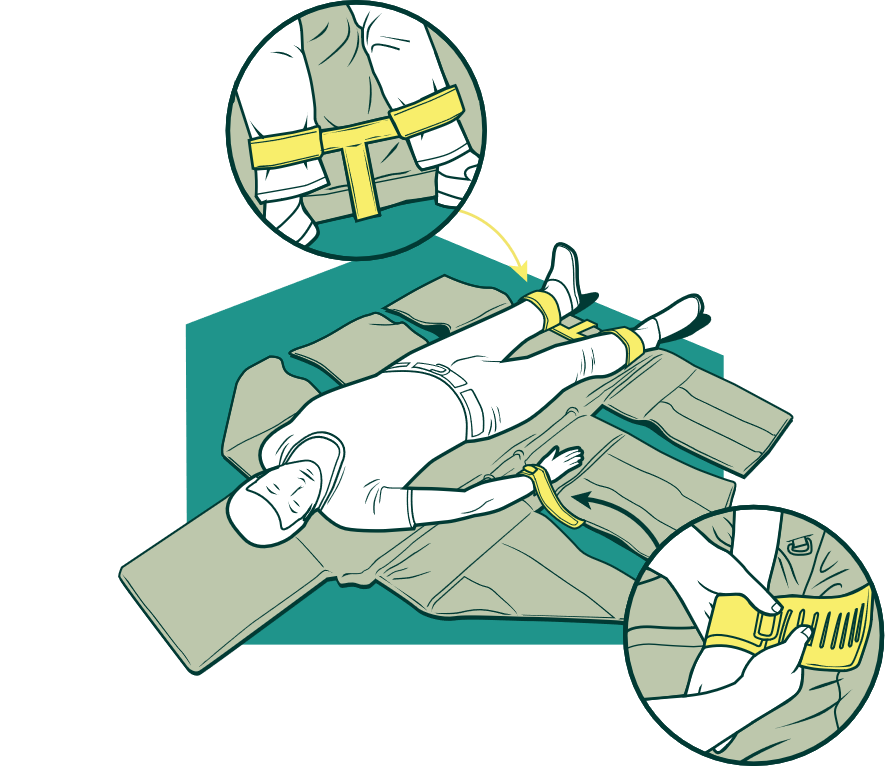 Did a Wrap Mat Kill Janaia? | The Echo