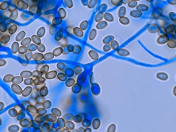 Fun With Microbiology (What's Buggin' You?): Scopulariopsis brumptii