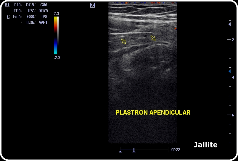 Plastron Apendicular