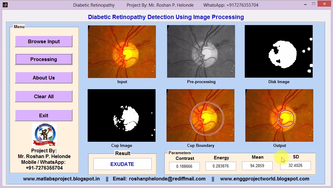 Matlab Code Diabetic Retinopathy Detection Using Image