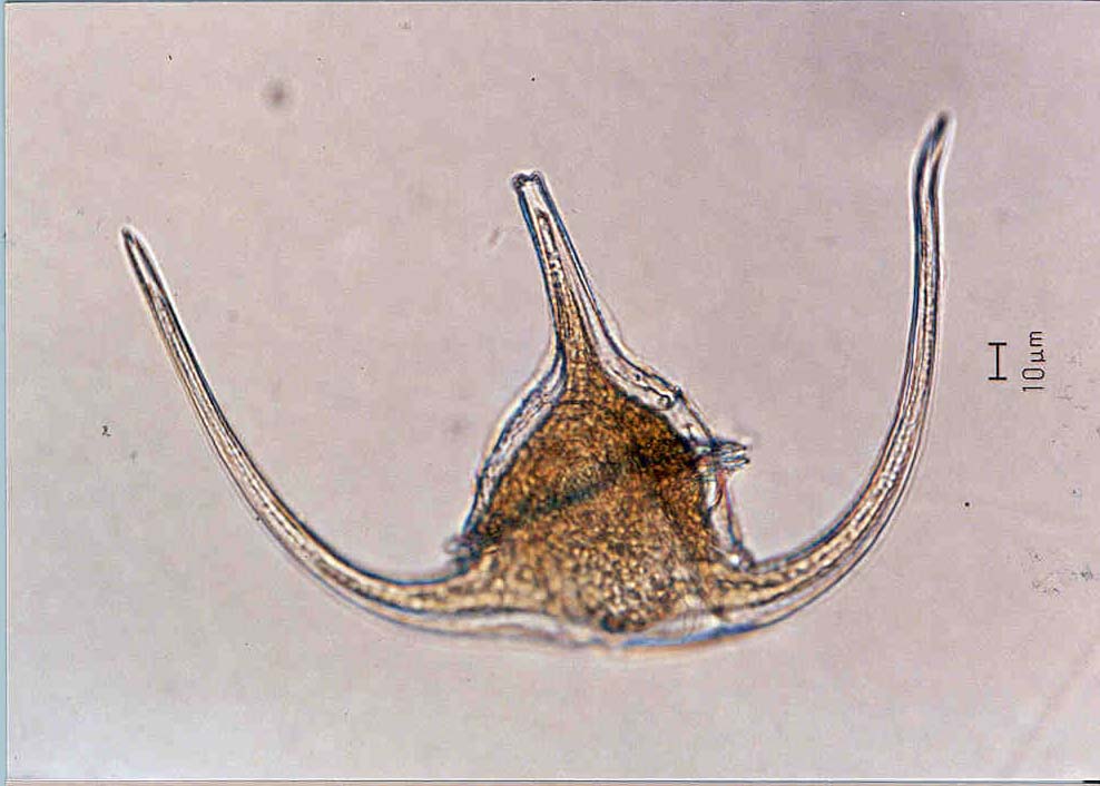 Catalogue of Organisms: Ceratium...er...Neoceratium...er...Tripos humilis