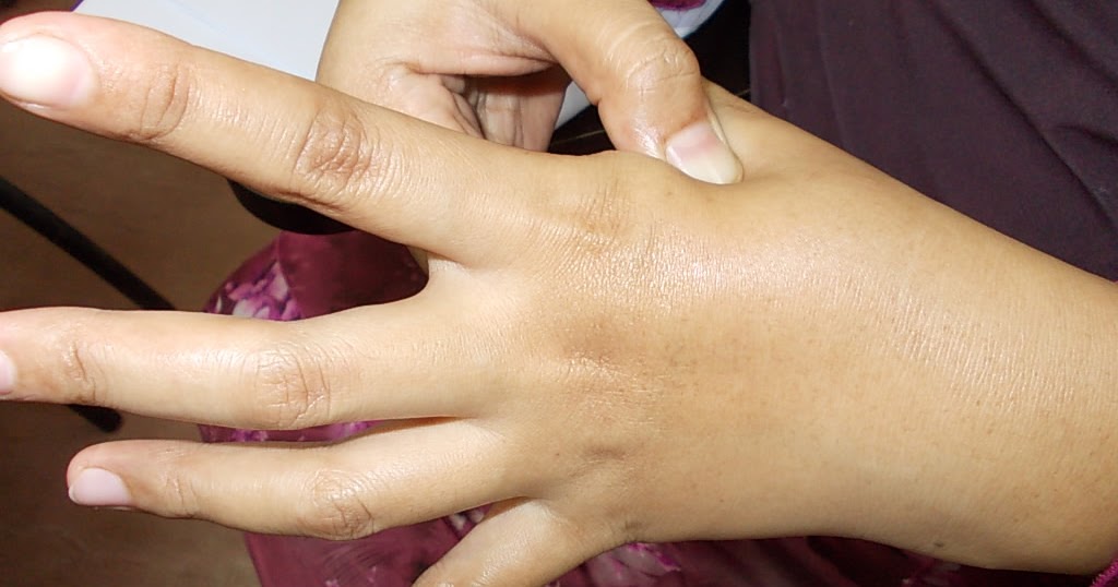 Sistem An Nisaa Online: Urut Tradisional Melayu - Kaedah Rawatan ...