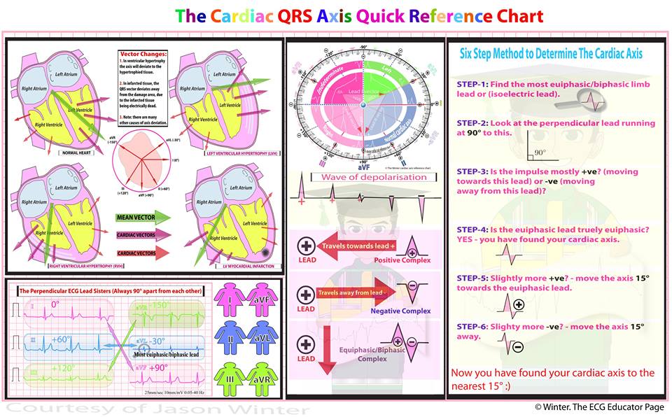 SAYANGI JANTUNG KITA: Gambar EKG & JANTUNG