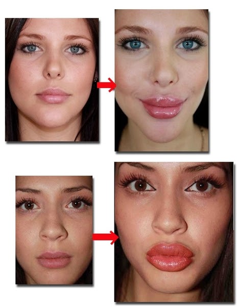 News Trend: How To Use The Lip Pump