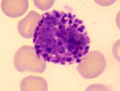 Atlas de Hematologia: Basófilo